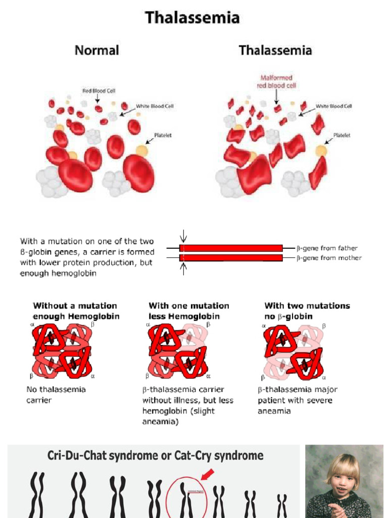 1. syndrome - การกลาย | PDF
