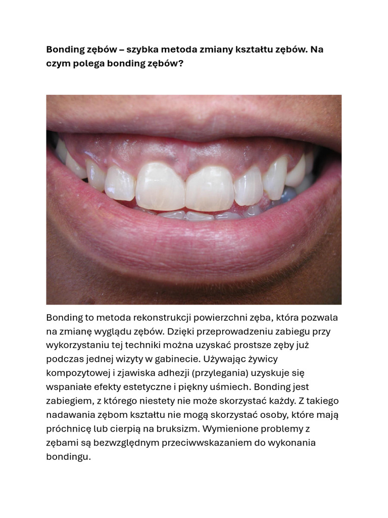 Bonding | PDF