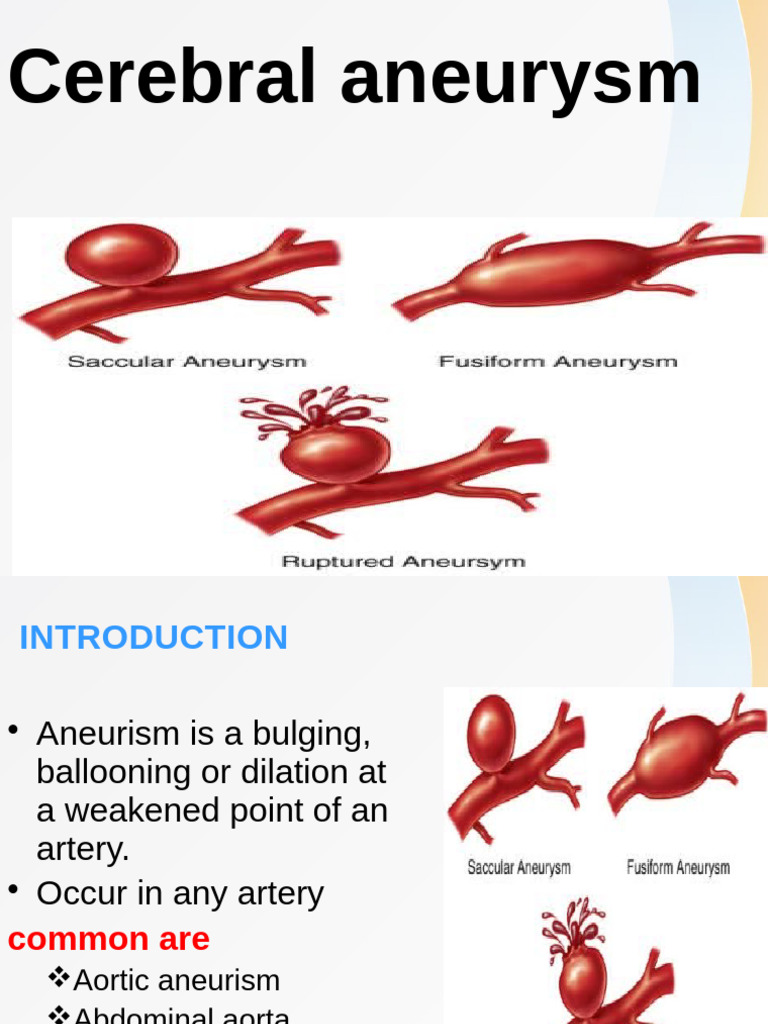 cerebral aneurysm | PDF | Vascular Diseases | Causes Of Death