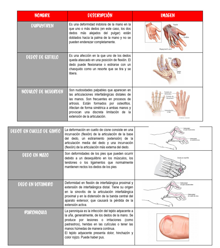 Signos de Mano | PDF | Sistema musculoesquelético | Enfermedades y ...
