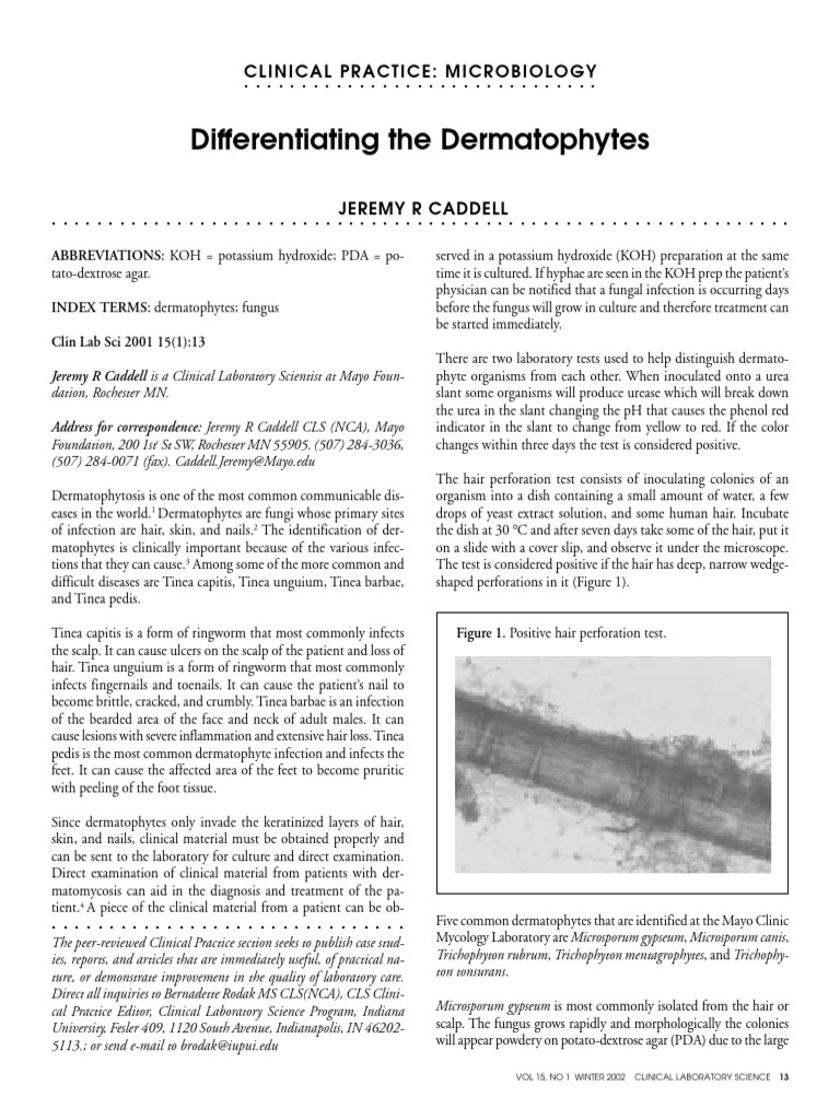 Identifying Common Dermatophytes | PDF | Diseases And Disorders ...