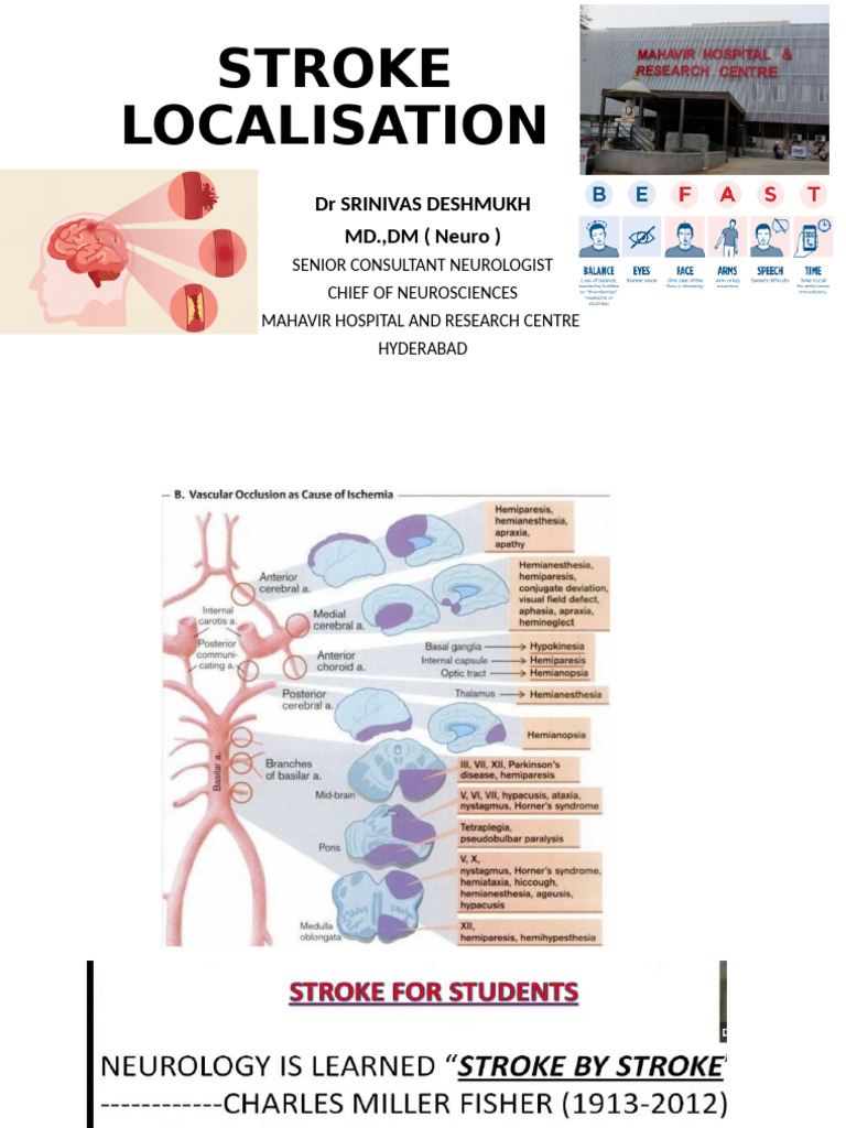 STROKE LOCALISATION | PDF