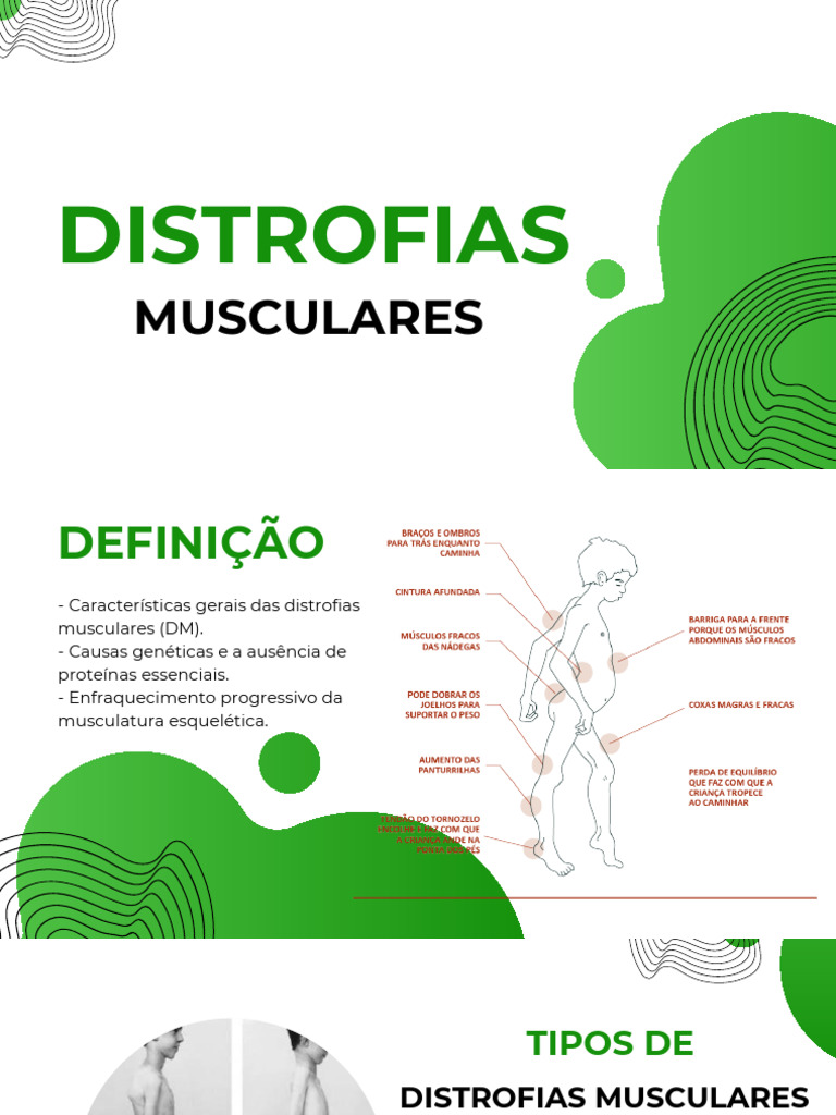 Distrofia Muscular | PDF