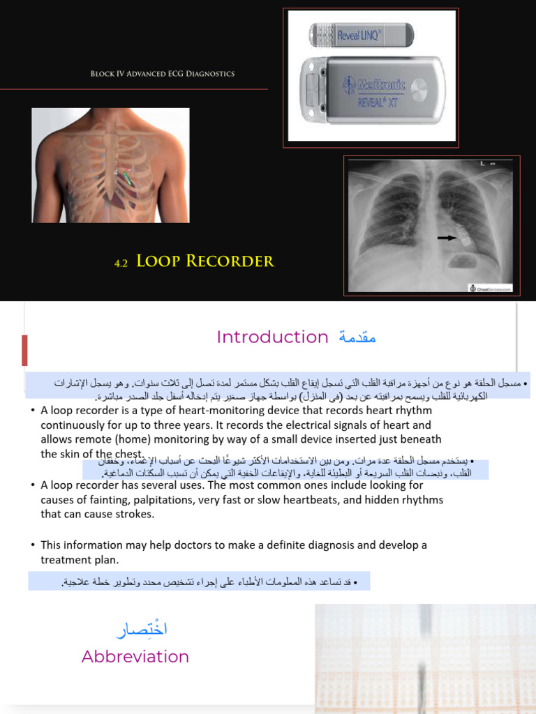 Understanding Implantable Loop Recorders | PDF | Artificial Cardiac ...