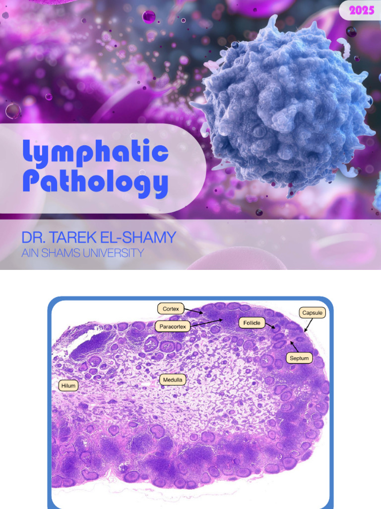 Lymphatic Pathology - 2025 | PDF | Lymph Node | Lymphatic System