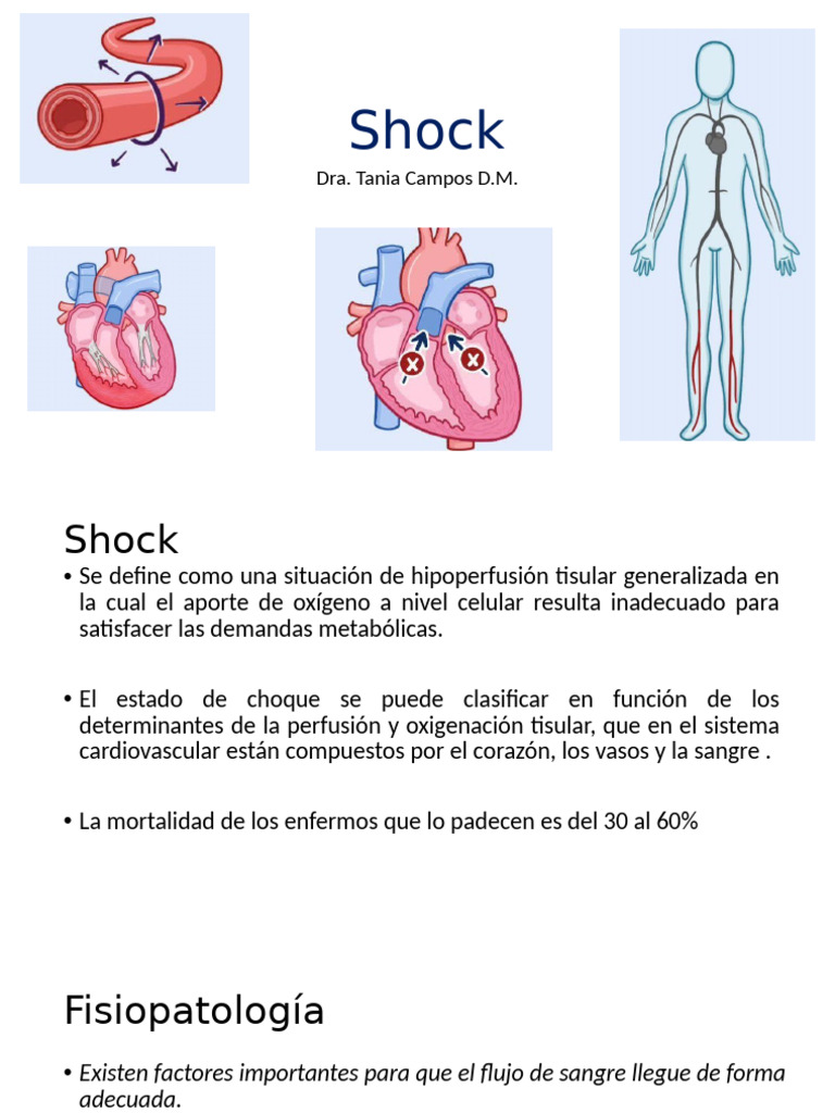 Tipos y Tratamiento del Shock Médico | PDF | Septicemia | Choque ...