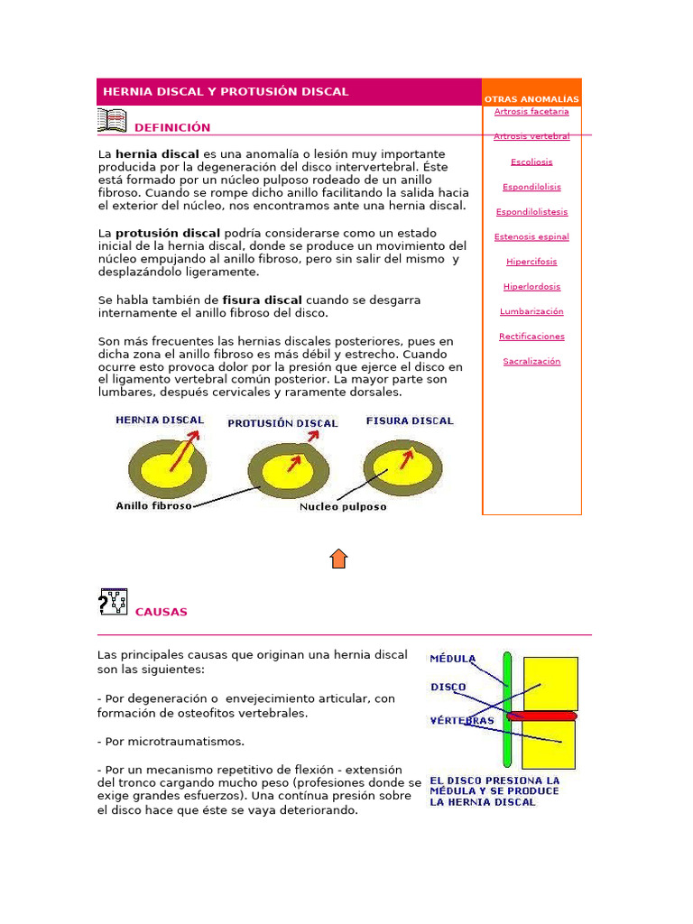 Hernia Discal y Protusión Discal | PDF | Anatomía humana | Sistema ...
