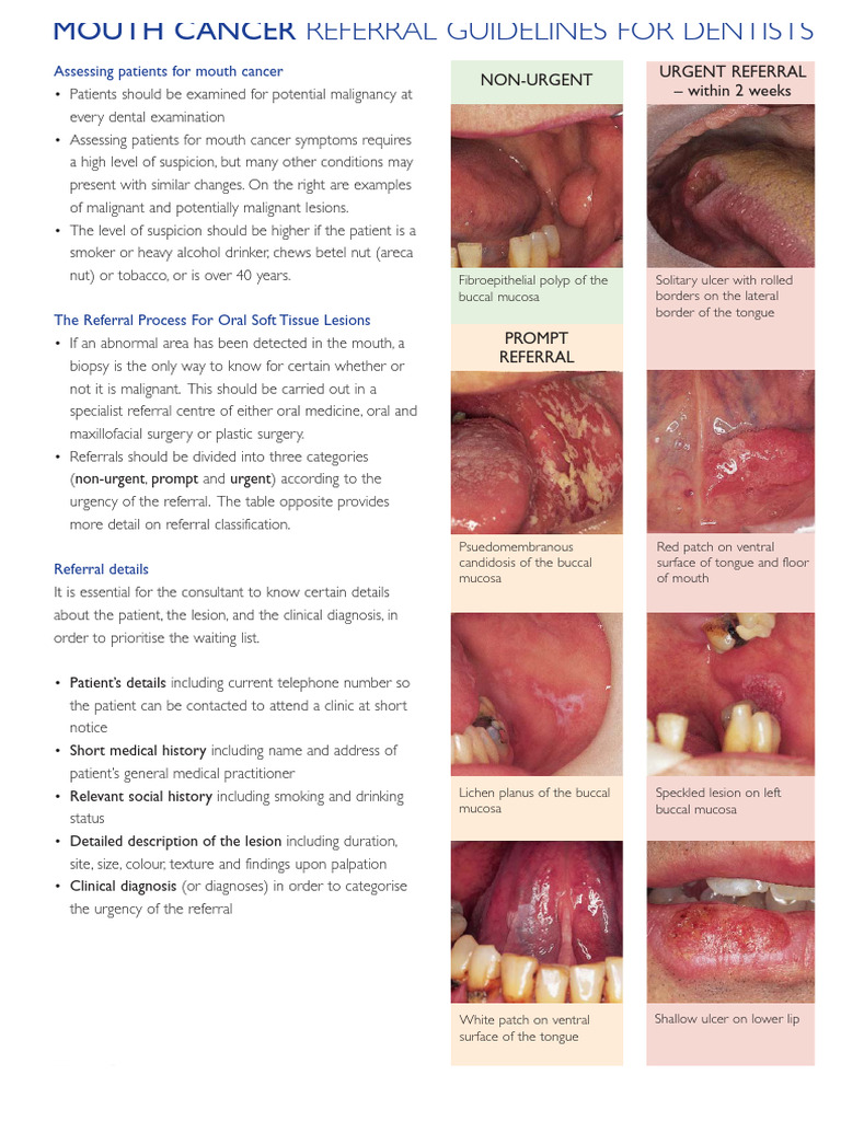 Mouth Cancer Referral Guidelines | PDF | Clinical Medicine | Diseases ...