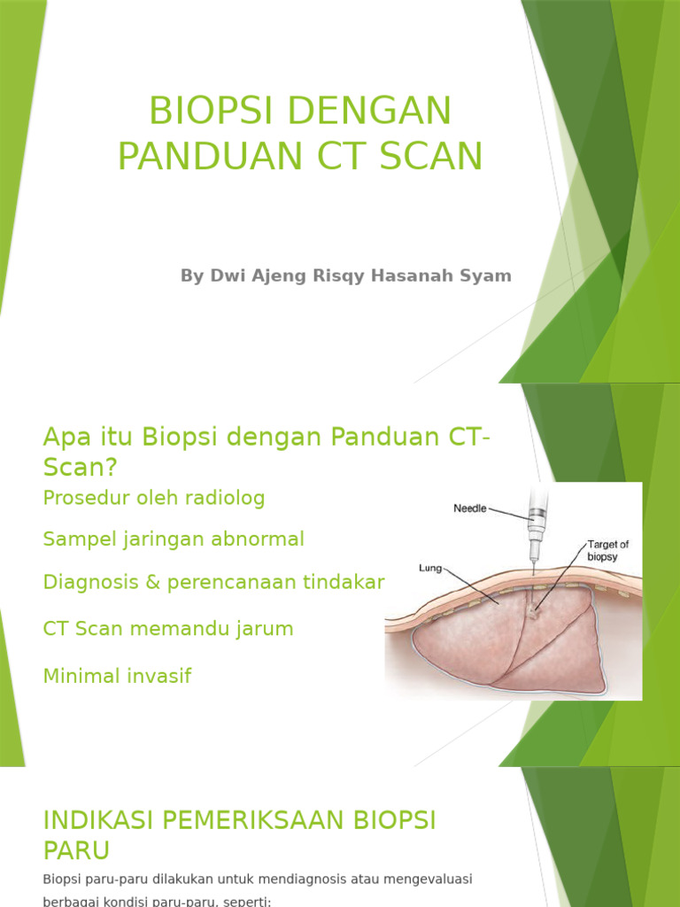 Pertemuan 6 Tekrad 5 - Biopsi Dengan Panduan CT Scan | PDF