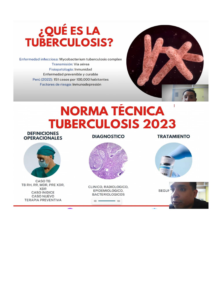 TBC Video Diapos | PDF