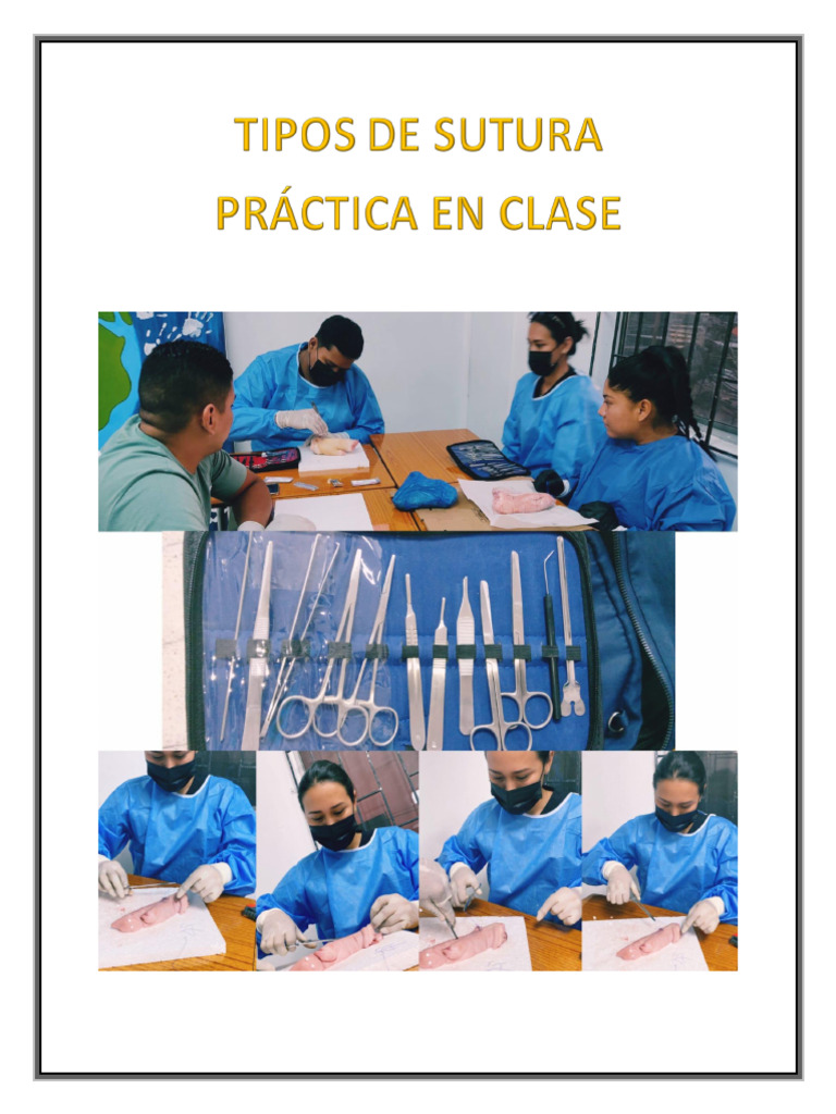 Tipos de Sutura | PDF