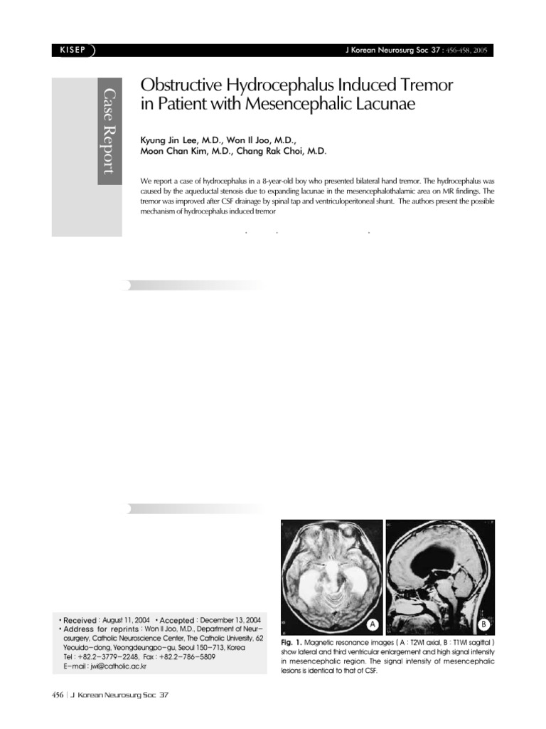 Obstructive Hydrocephalus Induced Tremor | PDF | Cerebrospinal Fluid ...