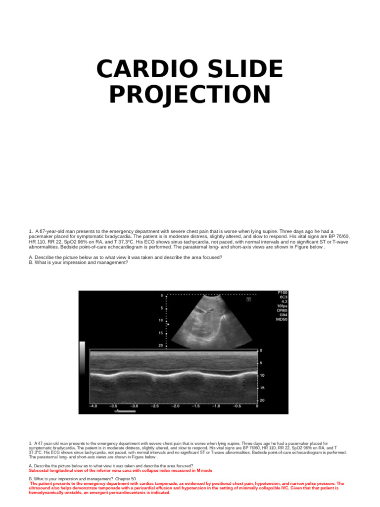 Cardio Slide Projection | PDF | Blood Pressure | Heart
