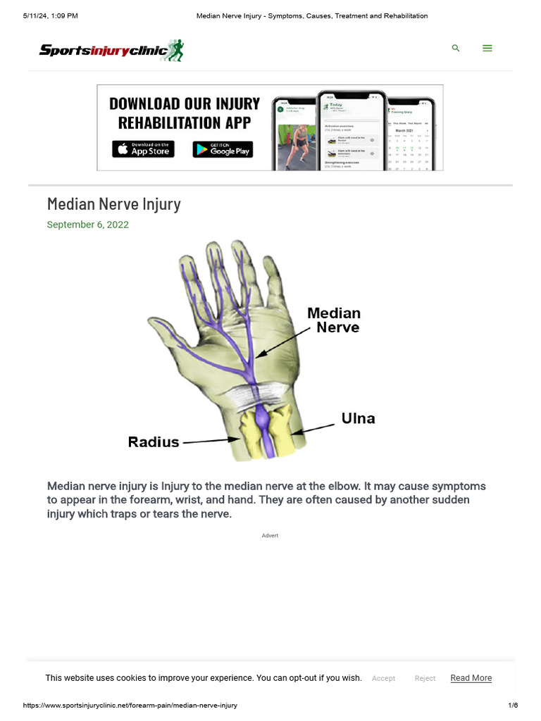 Median Nerve Injury - Symptoms, Causes, Treatment and Rehabilitation ...