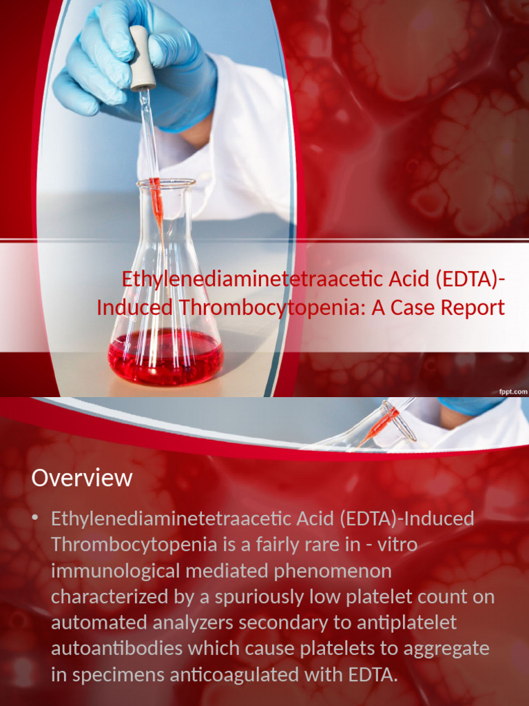 EDTA-Induced Thrombocytopenia Case Study | PDF | Platelet | Blood Cell