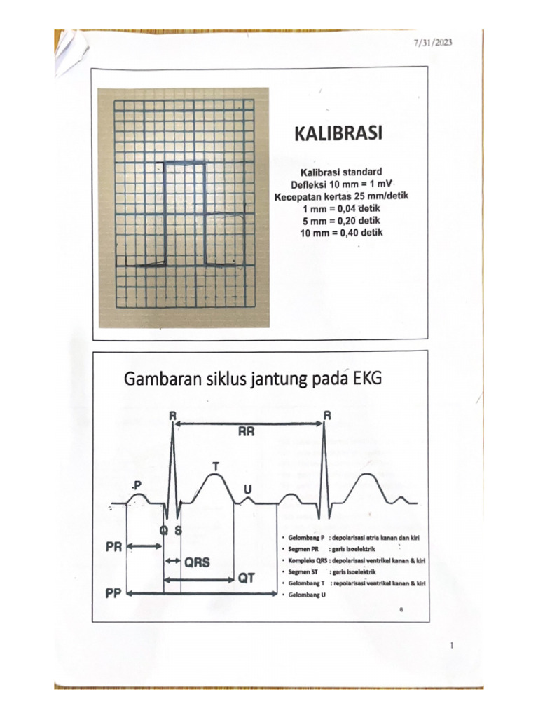 Dasar EKG Dan Kelainan | PDF