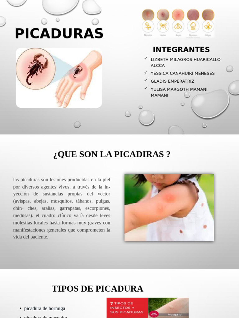 Tipos y síntomas de picaduras de insectos | PDF | Insectos | Avispa