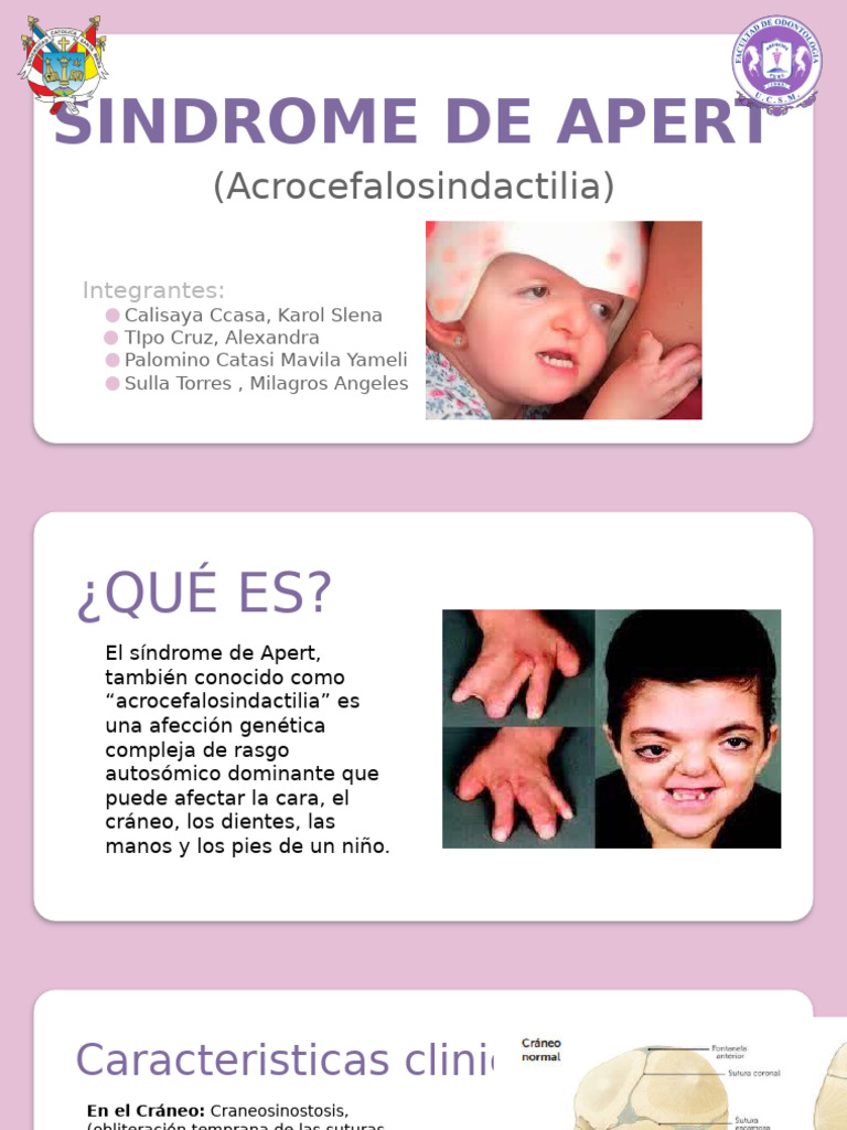 Características del Síndrome de Apert | PDF | Cráneo | Odontología