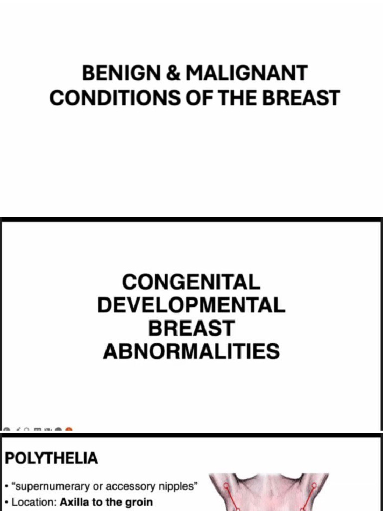 Benign and Malignant Conditions of The Breast | PDF
