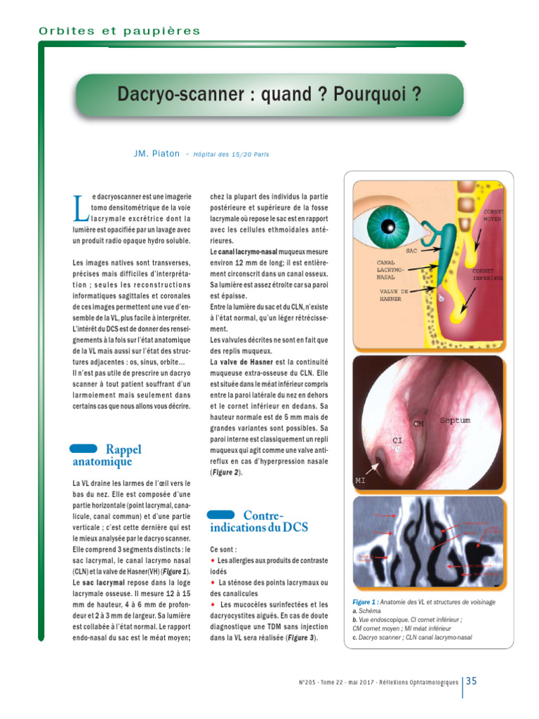 Dacryoscanner : Indications et Utilité | PDF | Tomodensitométrie ...