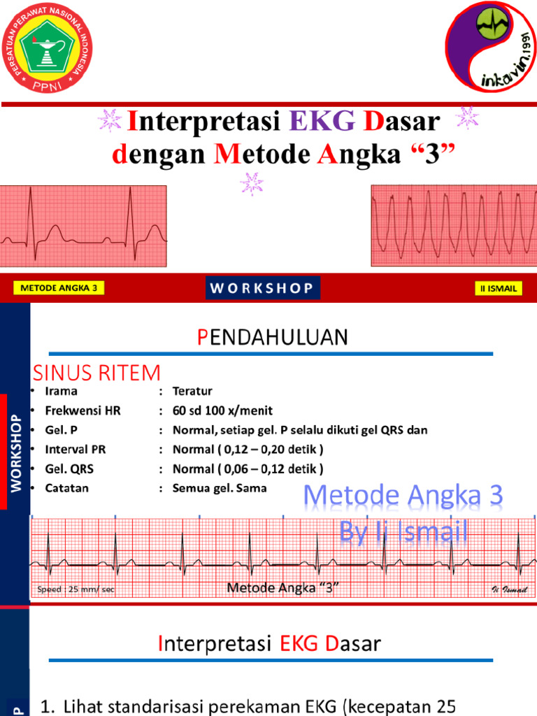 Interpretasi EKG Dasar Denngan Metode Angka 3 by II Ismail Untuk Peserta | PDF