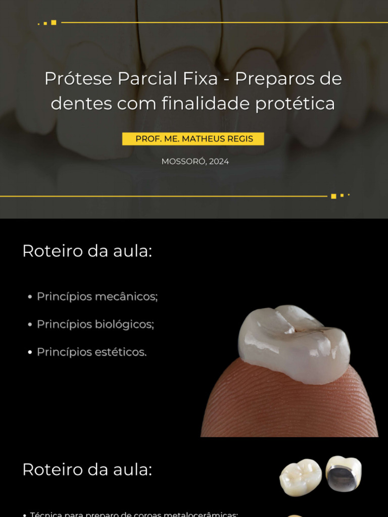 Aula 1 Prótese Fixa - Compressed | PDF