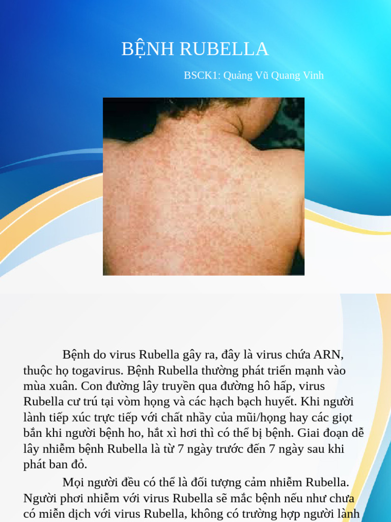 Rubella | PDF