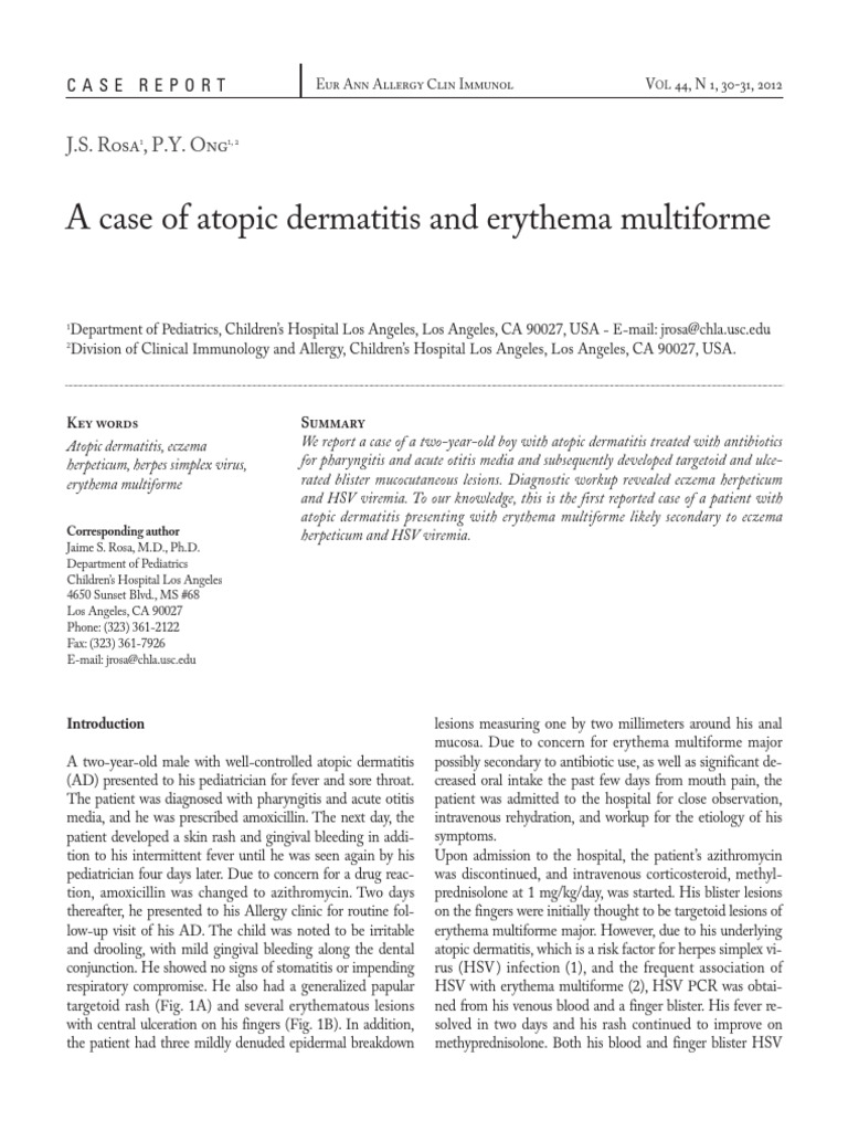 A Case of Atopic Dermatitis and Erythema Multiforme | PDF | Dermatitis ...