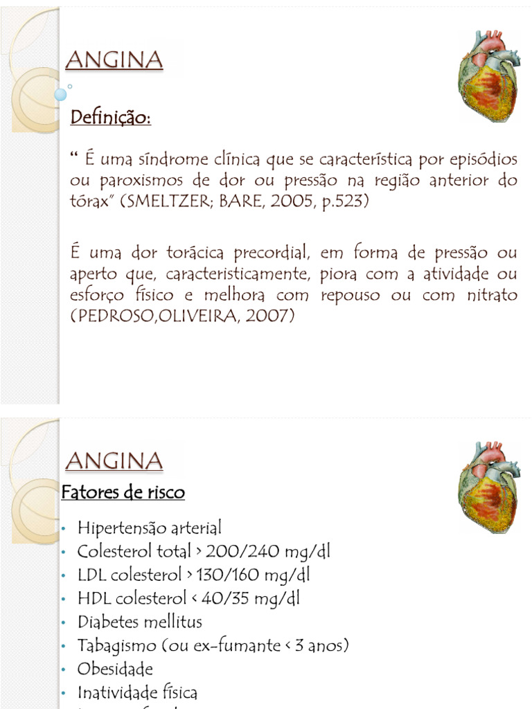Aula 02 Angina | PDF