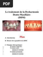 Pfe Les Plaques de Hawley | PDF | Orthodontie | Dent