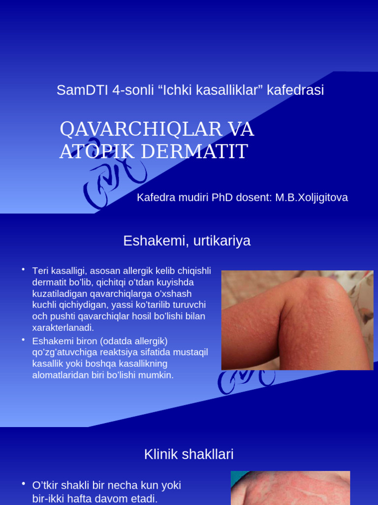 Atopik Dermatit | PDF