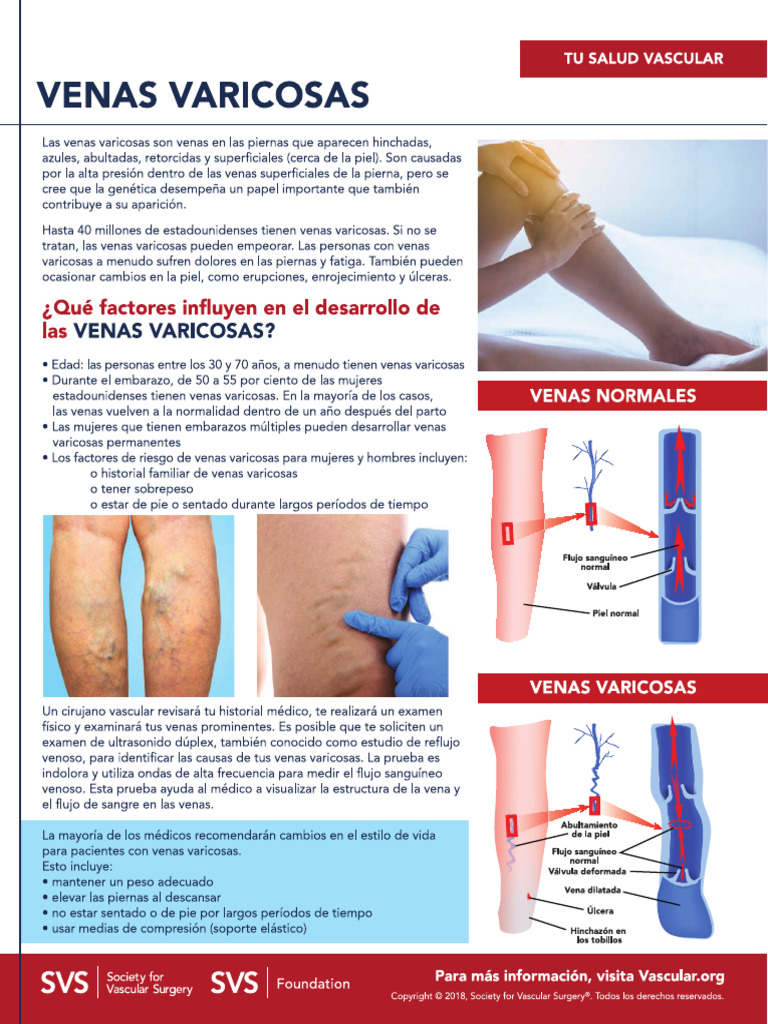 VV Flyer Spanish Link Opt | PDF