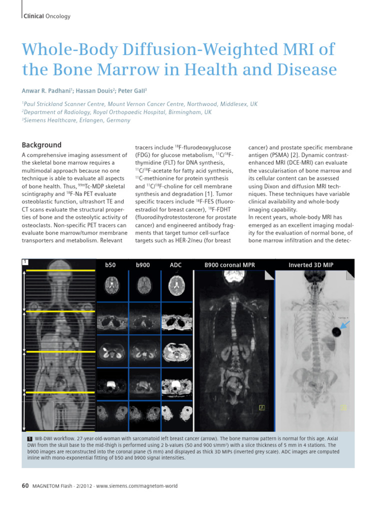 Whole Body Diffusion Weighted Mri of The Bone Marrow in Health and Disease-00284445 | PDF ...