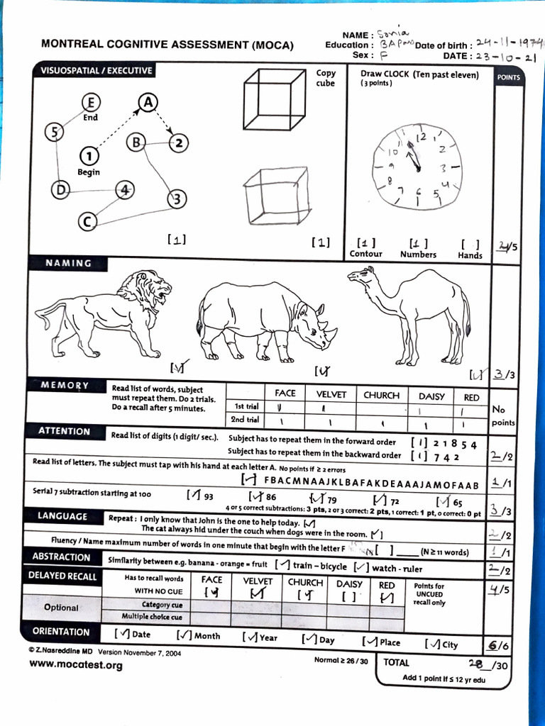 MOCA | PDF | Cognitive Science | Cognition
