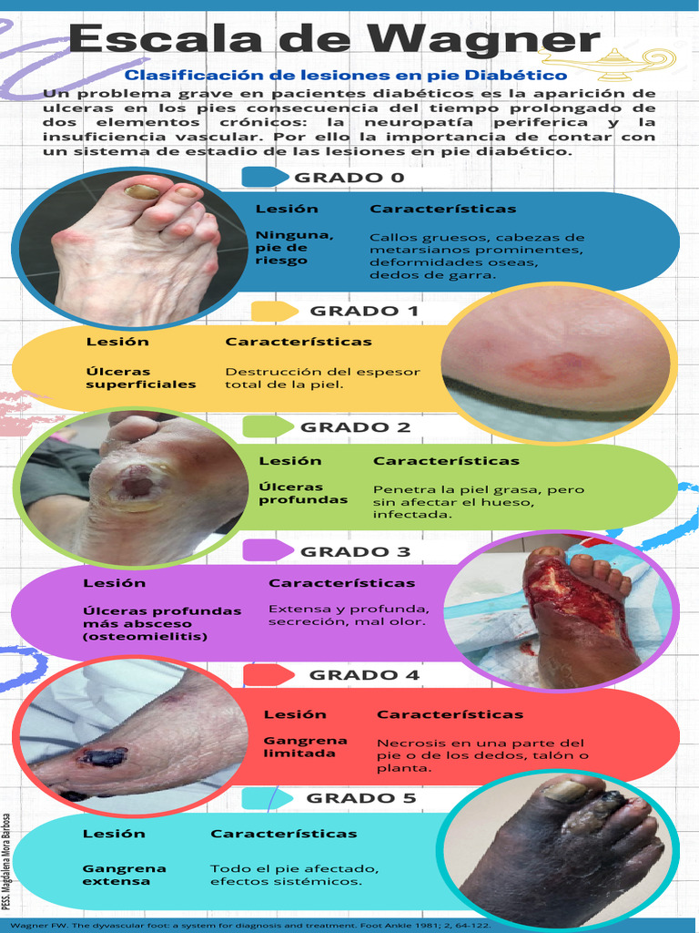 Clasificación Wagner del Pie Diabético | PDF | Epidemiología | Medicina