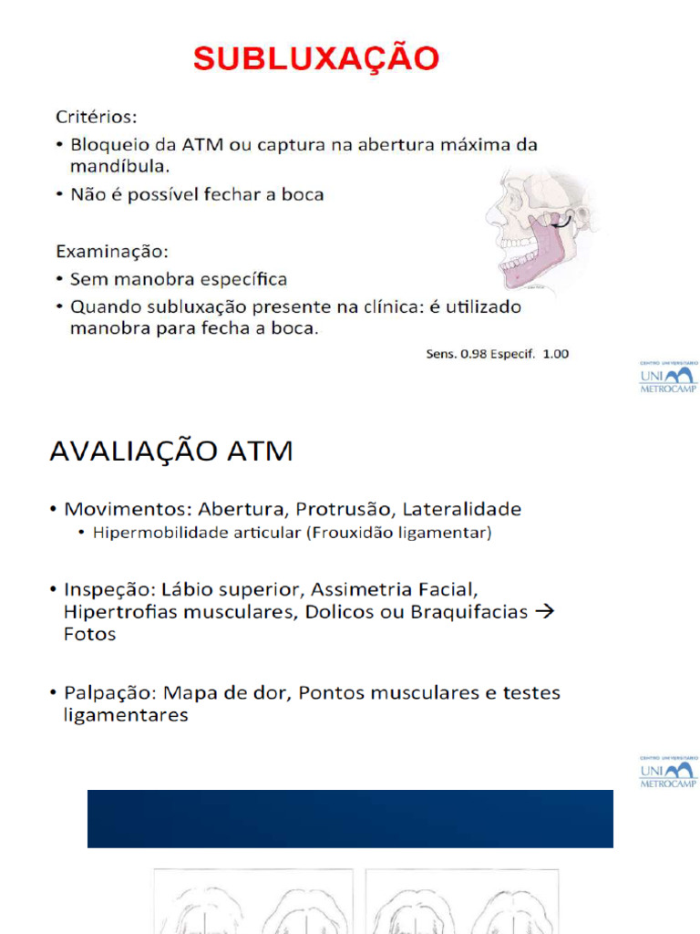 Cranio Mandibular - ATM Parte 4 | PDF | Anatomia humana | Anatomia