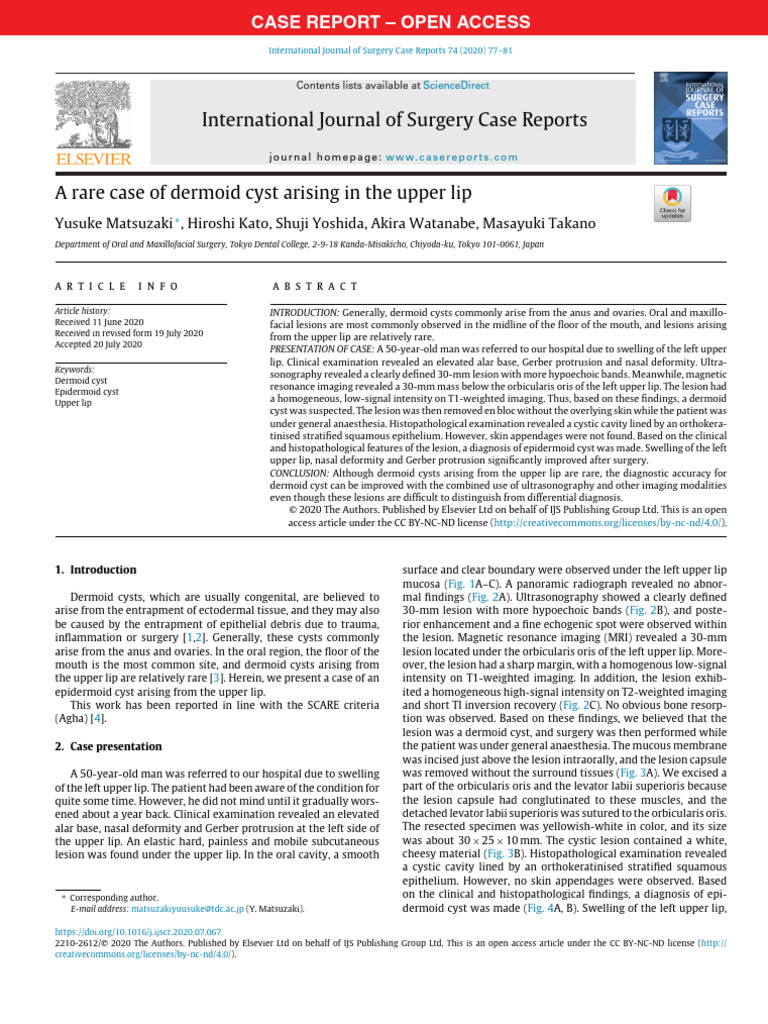 Rare Upper Lip Dermoid Cyst Case Report | PDF | Epithelium | Anatomy