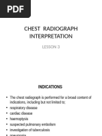 Chest Imaging Techniques and Pathologies | PDF | Thorax | Radiology