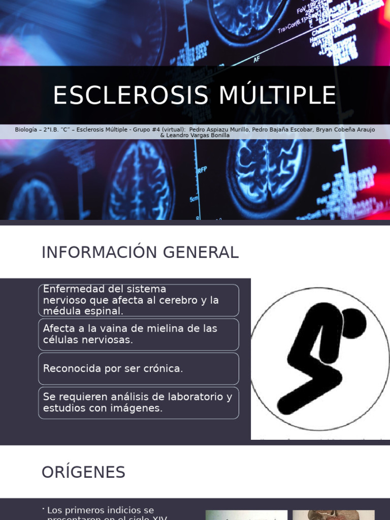 Esclerosis Múltiple | PDF | Esclerosis múltiple | Enfermedad autoinmune