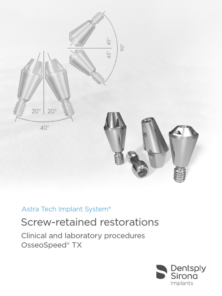 1235869 Screw_retained Restorations | PDF | Dental Implant | Dentistry ...