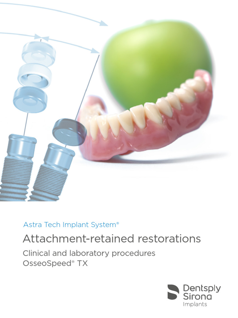 Attachment - Retained Restorations | PDF | Dental Implant | Dentures