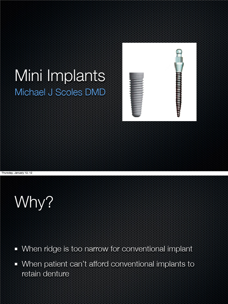 mini implants | PDF | Dental Implant | Dentures