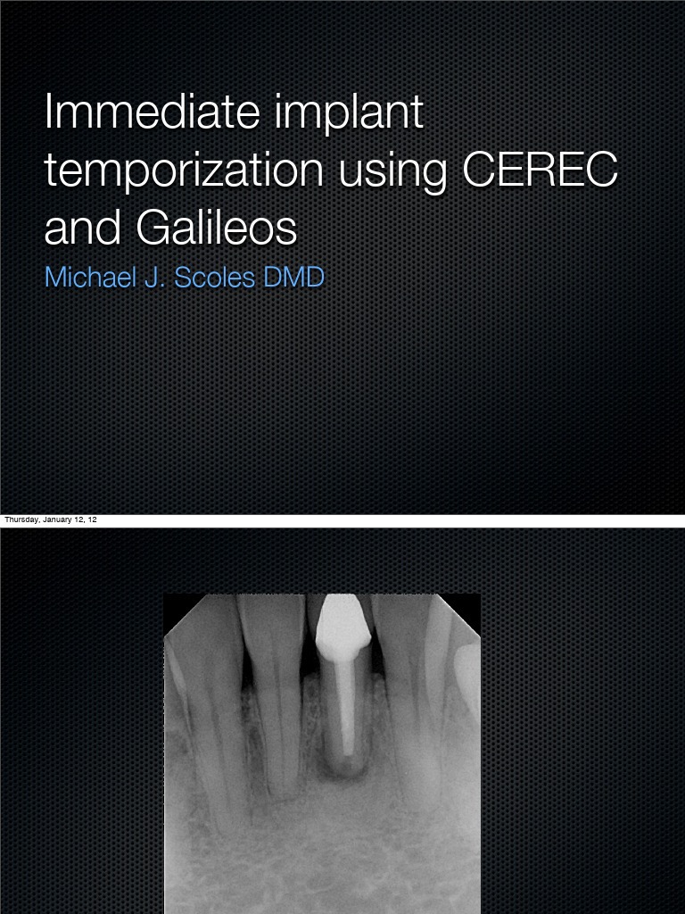 Immediate Implant Temporize Using Cerec and Galileos | PDF