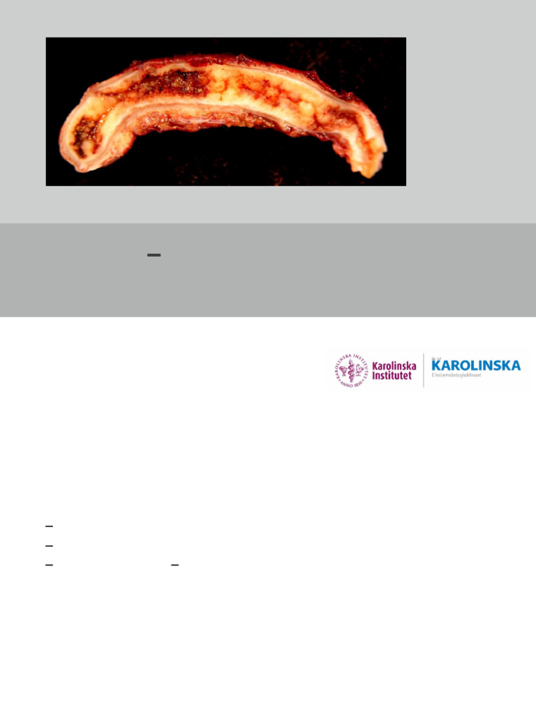 Akut Buk - Del 2: Cecilia Wredberg | PDF