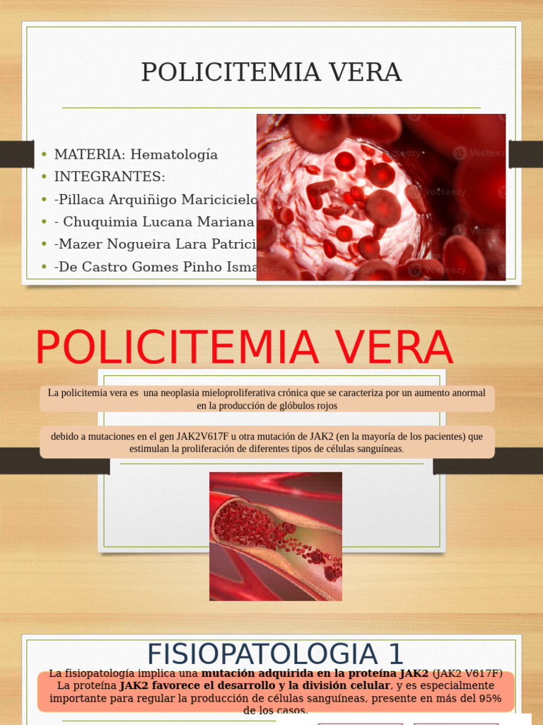 Policitemia Vera Presentacion | PDF | Sangre | Hematopoyesis