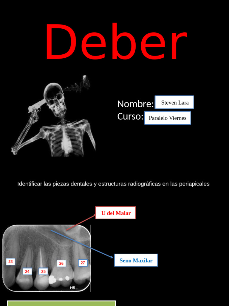 Taller Anatomia intraorales y Panoramica (STEVEN LARA) (1) | PDF
