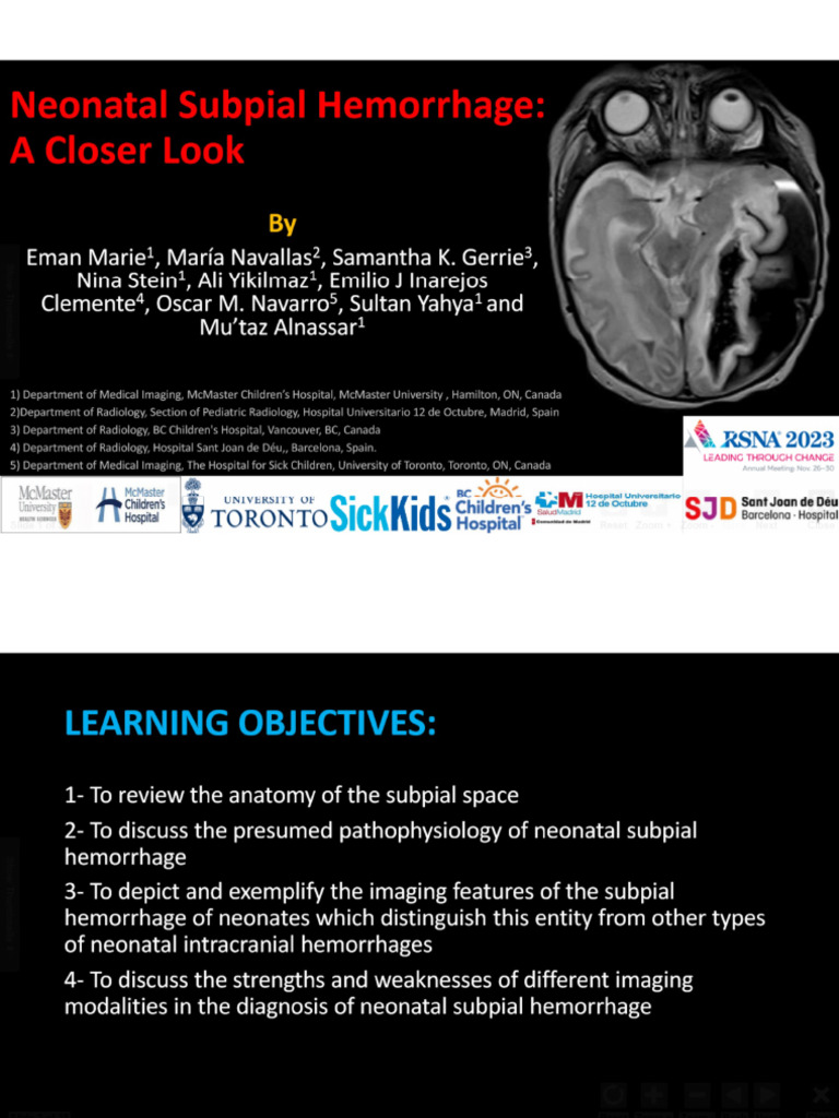 Ped Neonatal Subpial Hemorrhage | PDF