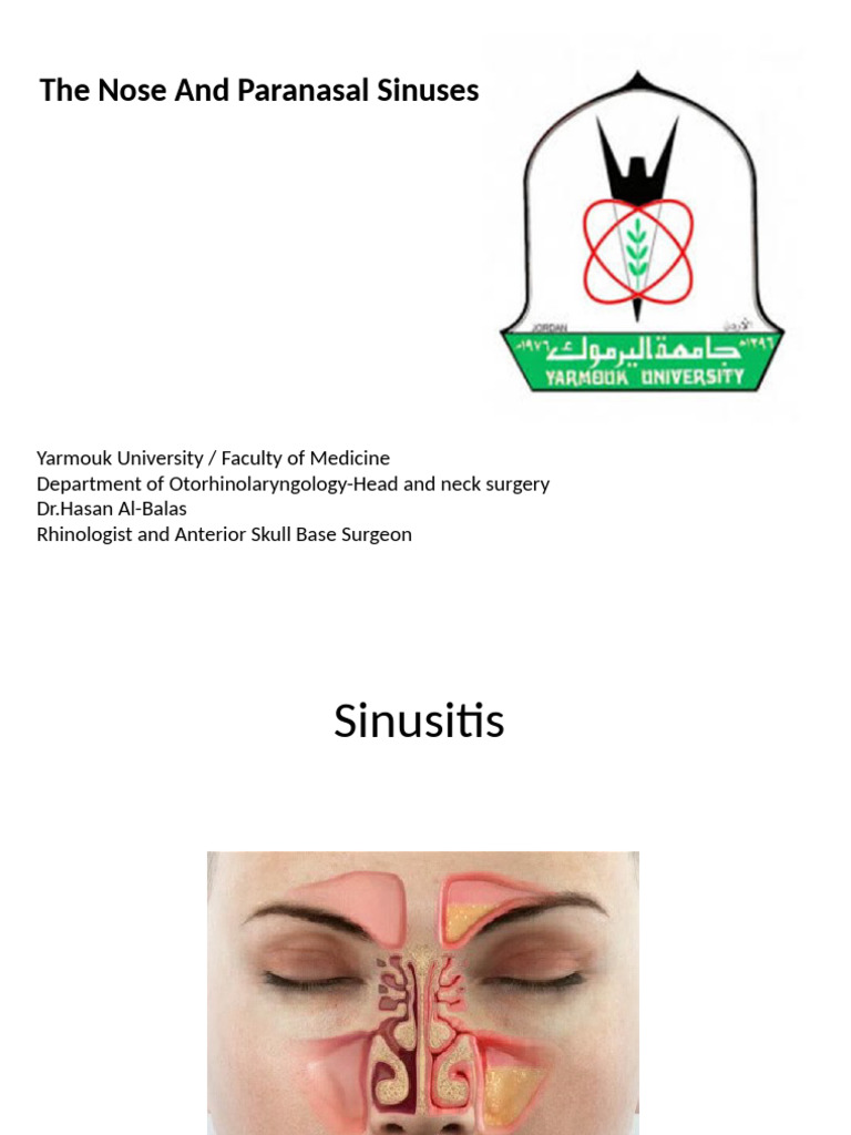 Nose, Sinuses, Acute Rhinosinusitis & Chronic Rhinosinusitis and Epistaxis Part 2 Dr. Hasan ...