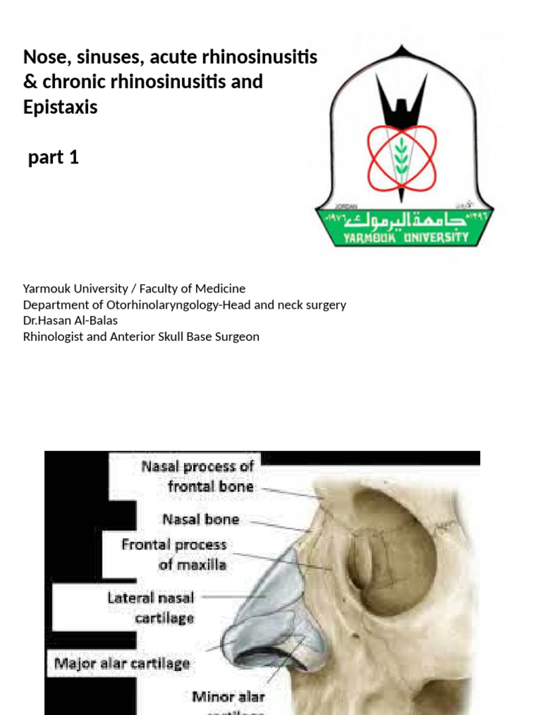 Nose, Sinuses, Acute Rhinosinusitis & Chronic Rhinosinusitis and ...