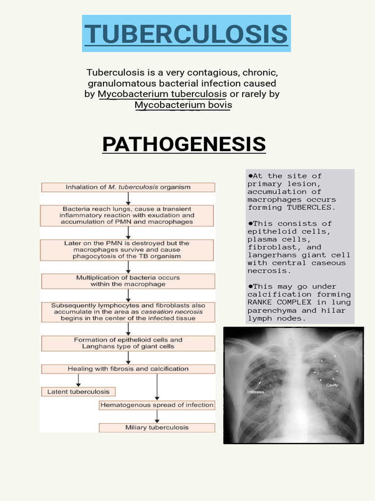 Tuberculosis Is A Very Contagious, Chronic, Granulomatous Bacterial ...